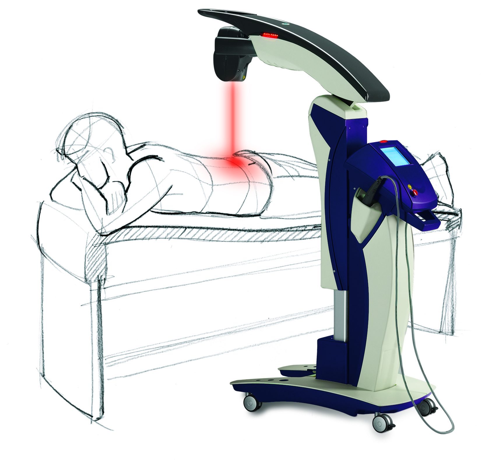 Deep Tissue Laser Therapy: A Powerful Solution for Pain and Healing in ...